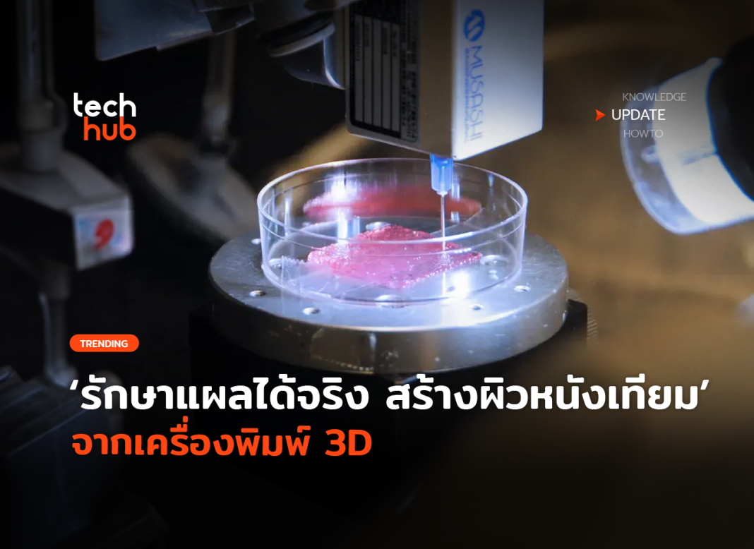 รักษาแผลได้จริง สร้างผิวหนังเทียม จากเครื่องพิมพ์ 3D - techhub